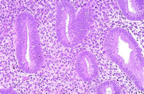 What Is Proliferative Phase Endometrium And Secretory Endometrium