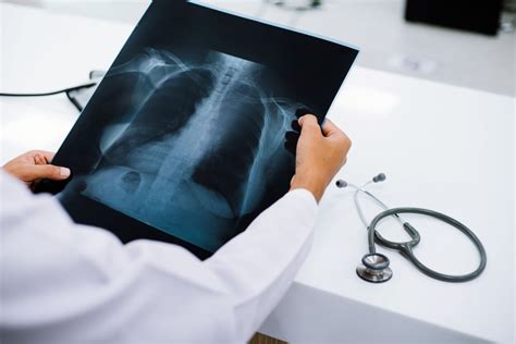 Cosa Si Vede Da Un RX Al Torace E A Cosa Serve