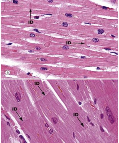 Histology Of Blood Vessels Flashcards Quizlet