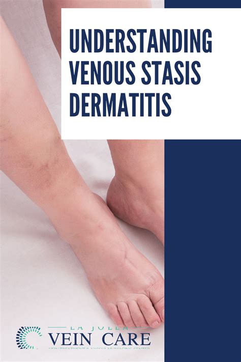 Causes Of Venous Stasis Dermatitis