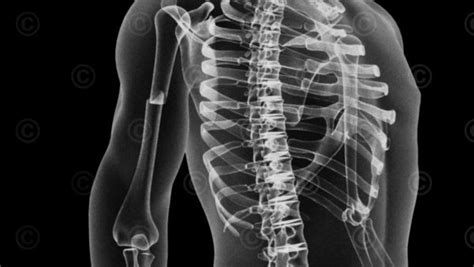 Illustrationen Anatomie Nerven MedicalGraphics