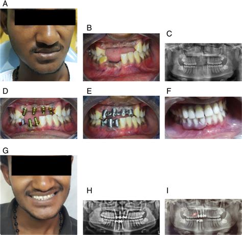 The Patient S Code 03 Presentation A Patient S Photograph Presents