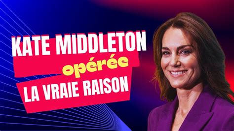 Kate Middleton Révélation sur son opération abdominale la vérité