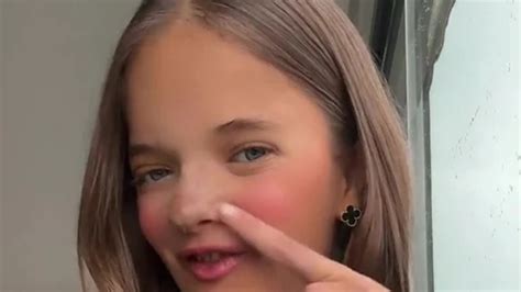 Foto 1 mês após rinoplastia Rafaella Justus volta a exibir resultado
