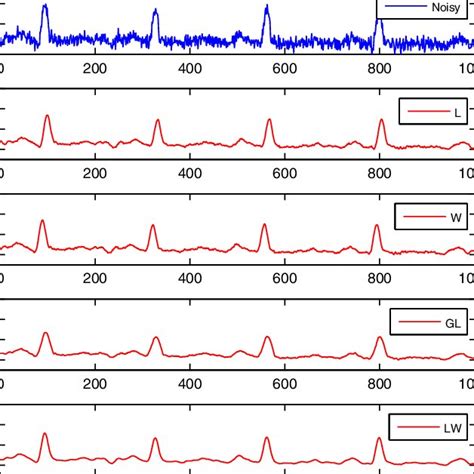 ecg signal with a 50 hz disturbance noise and filtered signals using l download scientific