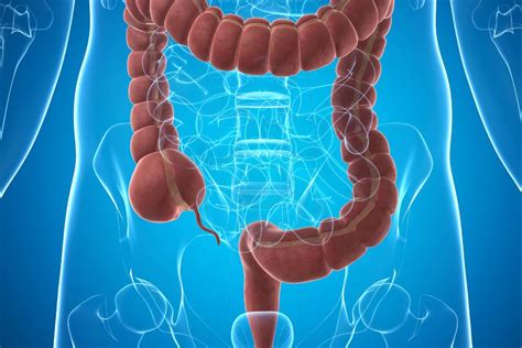 Wrzodziejące zapalenie jelita grubego objawy diagnostyka leczenie