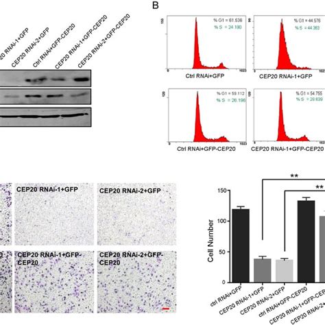 Depletion Of CEP20 Inhibits Cell Proliferation And Cell Migration A549