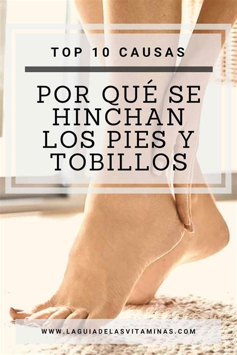 Por qué se hinchan los pies Sujeto