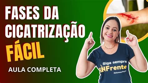 FASES DA CICATRIZAÇÃO FERIDAS Entenda facilidade Aula Completa