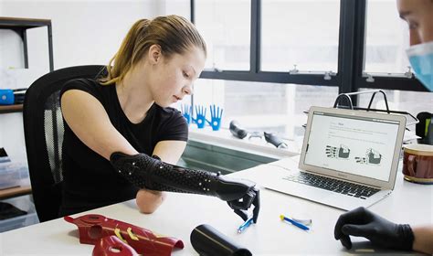 What Is A Myoelectric Hand Open Bionics