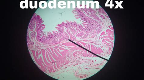 THEONEDESTINY Duodenum Histology