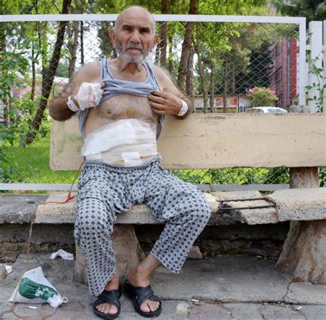 Safra Kesesi Ameliyatı Olan Hastadan Doktora İhmal Suçlaması Son Dakika