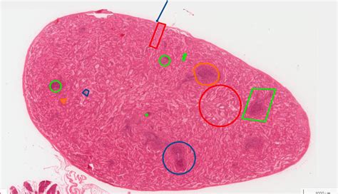 Spleen Diagram Histology