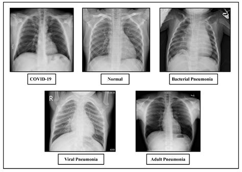 Diagnostics Free Full Text DTLCx An Improved ResNet Architecture