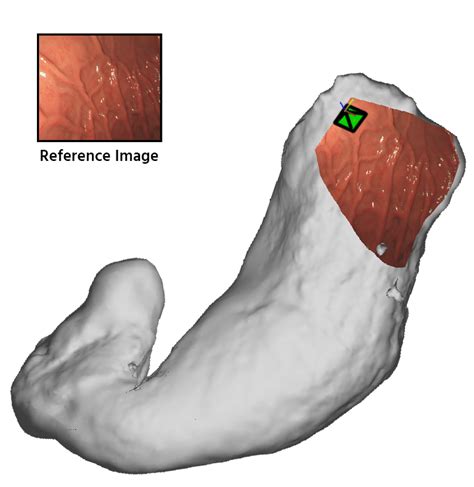 two examples of the frame localization an input reference image was download scientific