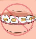How To Apply Dental Wax On Braces 11 Steps With Pictures