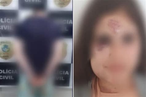 Ex sargento do Exército é preso após espancar companheira em