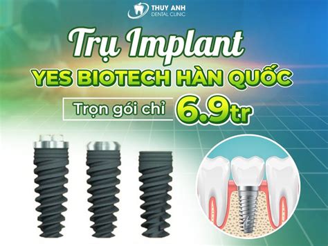 Tìm hiểu trụ implant Yes Biotech ưu và nhược điểm