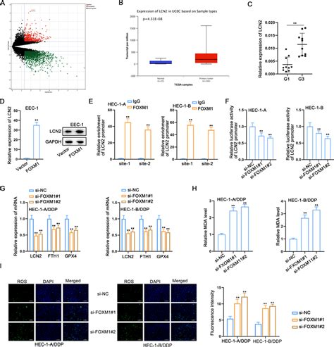 Foxm Inhibits Ferroptosis In Ddp Resistant Cells By Upregulating Lcn