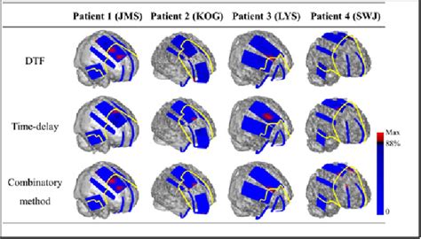 figure 2 from combined use of multiple computational intracranial eeg analysis techniques for