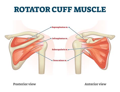 Recovery Time For Torn Rotator Cuff Without Surgery TSAOG