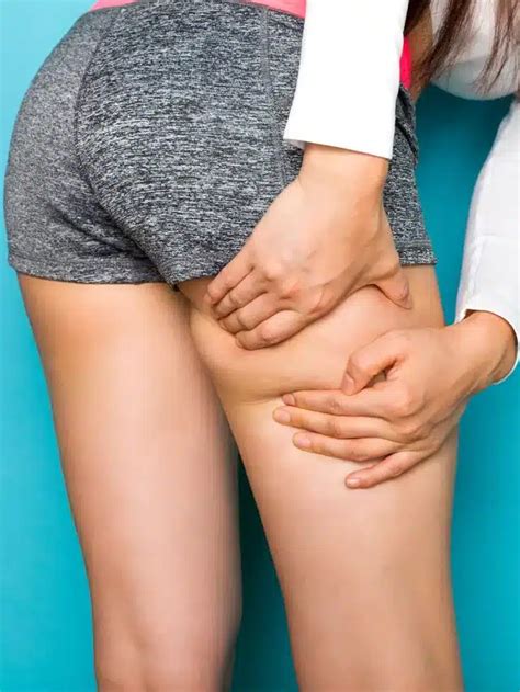 Quais os Melhores Exercícios para Posterior de Coxa Rafael