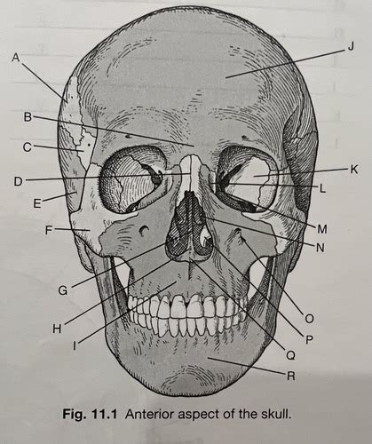 Rads Skull Sinus Anatomy Flashcards Quizlet