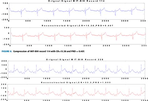 figure 1 from an energy efficient compression algorithm of ecg signals in remote healthcare
