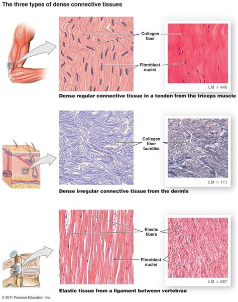 Types Of Dense Connective Tissue Tissue Types Tissue Biology Basic