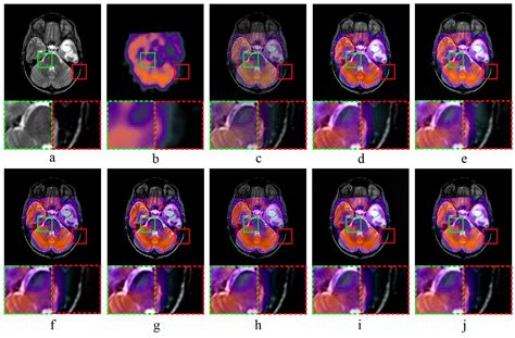 sensors free full text multi modality medical image fusion using convolutional neural