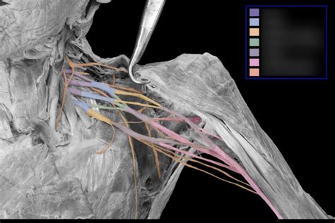 Cadaver 19 Plexus Brachialis Allgemein Diagram Quizlet