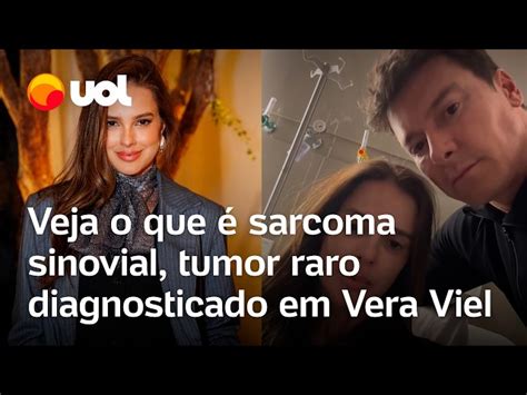 O que é sarcoma sinovial tumor de Vera Viel mulher de Rodrigo Faro