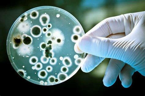 Hãy kể tên một số phương pháp nghiên cứu vi sinh vật Nêu ý nghĩa của