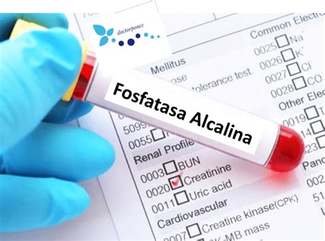 Entendiendo la fosfatasa alcalina Qué indican los niveles elevados o