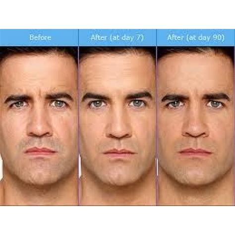 Clínica para Aplicar Botox Cotanet