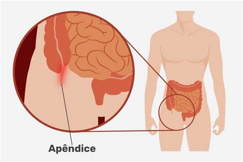 Diagram Of Right Abdominal Pain