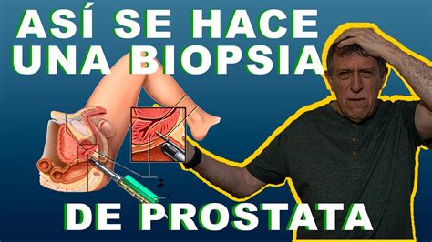 Biopsia de próstata Técnica y consecuencias YouTube