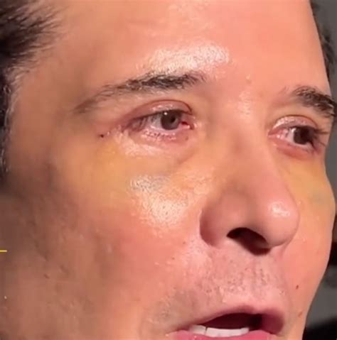 Gustavo Adolfo Infante responde tras ser recibir críticas por someterse