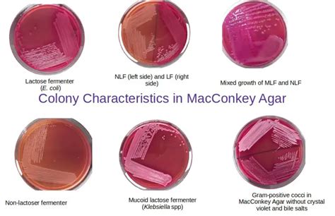 MacConkey Agar Composition Uses Colony Characteristics