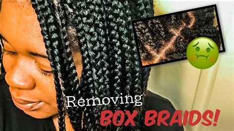 How To SAFELY Remove Box Braids YouTube
