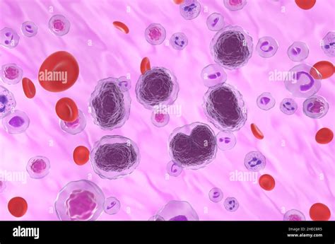Non Hodgkin Lymphoma NHL Cells In The Blood Flow Isometric View 3d