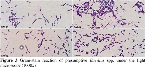 Pseudomonas Aeruginosa Gram Stain X