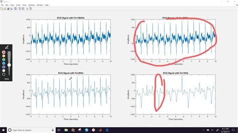 modeling an ecg signal in matlab youtube