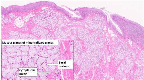 Tongue Normal Histology Nus Pathweb Nus Pathweb