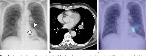 development and validation of deep learning based automatic detection algorithm for malignant