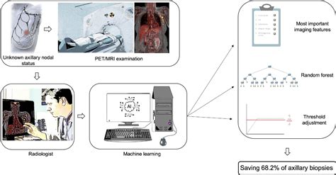 O Modelo De Aprendizado De Máquina PET MRI Pode Eliminar A Biópsia Do