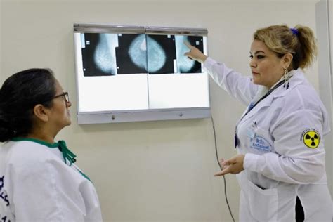 EsSalud Cusco aplica técnica para detección precoz de cáncer de mama