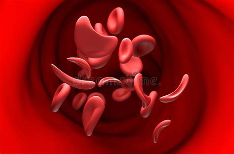 Sickle Cell Anaemia Section View 3d Illustration Stock Illustration