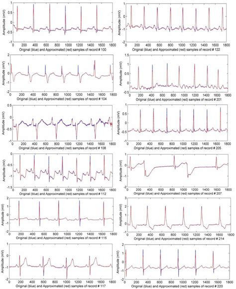 original noisy shown in blue ecg signals superimposed with 400th download scientific diagram