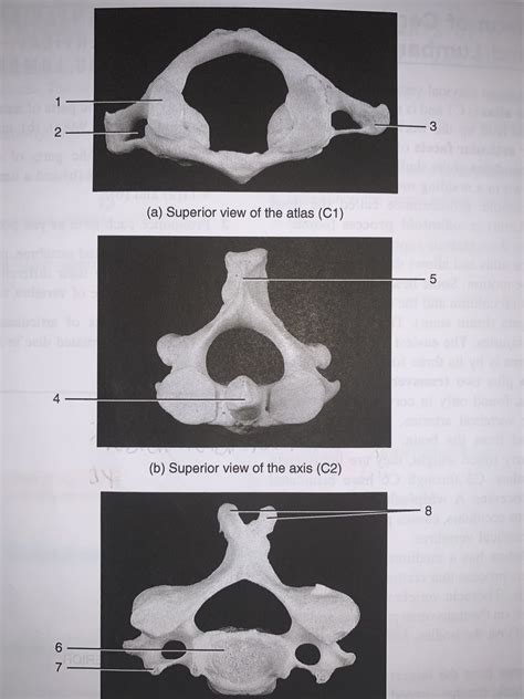 Axial Skeleton Quiz 5 Diagram Quizlet